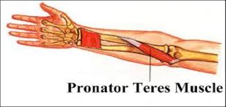 Pronator Syndrome - Jonathan Aarons MD/ Pain Management