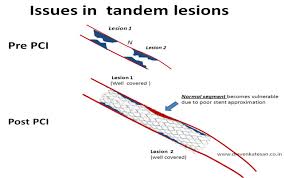 英和画像辞典：(lesion)の関連画像一覧！